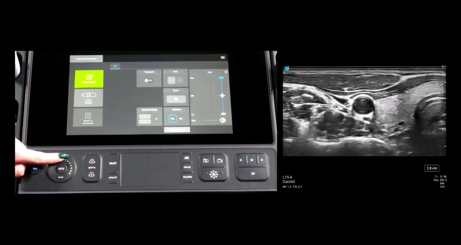 Product Training | Sonosite Institute for Point-of-Care Ultrasound